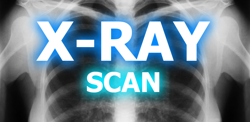 Как скачать X-Ray Scan на мобильный телефон