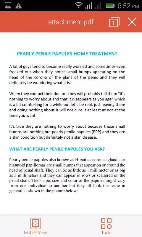 Pearly Penile Papules Removal Toothpaste