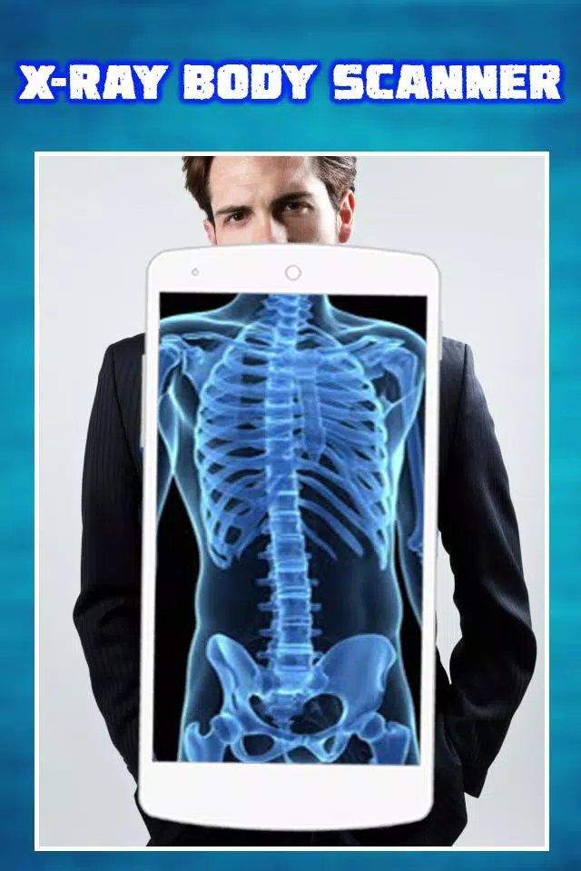 X Ray Whole Body