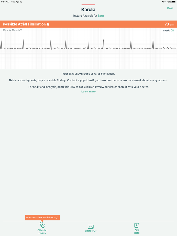 Kardia for iOS (iPhone/iPad/Apple Watch/iPod touch) - Free Download at ...