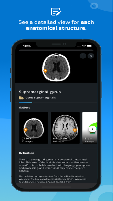IMAIOS e-Anatomy for iOS (iPhone/iPad) - Free Download at AppPure