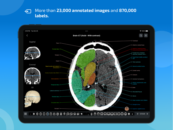 IMAIOS e-Anatomy for iOS (iPhone/iPad) - Free Download at AppPure