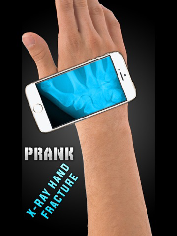 Simulator X-Ray Hand Fracture for iOS (iPhone/iPad/iPod touch) - Free ...