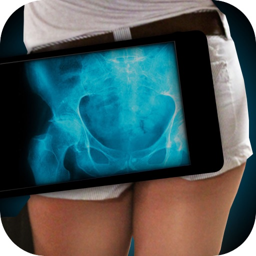 Iosiphoneipadipod Touch용 Simulator X Ray Photo Hip Bone Apppure에서 무료 다운로드