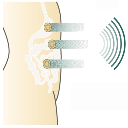 GTech-Patch-Monitor Gen 2 for iOS (iPhone/iPad/iPod touch) - Free ...