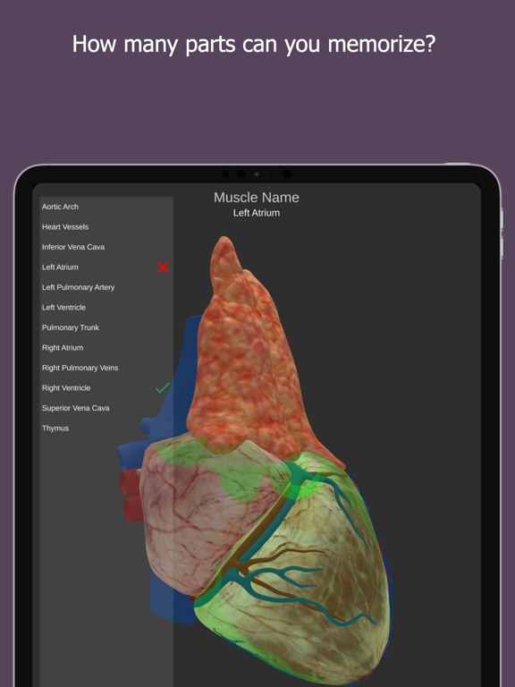 Anatomy Of The Human Heart for iOS (iPhone/iPad/iPod touch) - Free ...