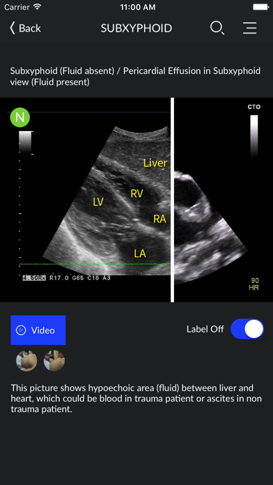 RESUS Ultrasound LITE for iOS (iPhone/iPod touch) - Free Download at ...