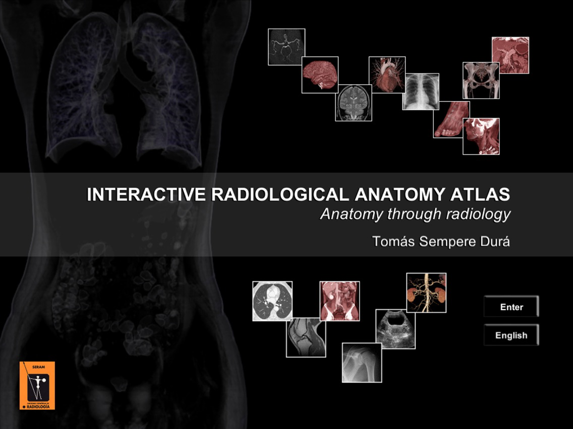 Interactive radiological anatomy atlas for iOS (iPhone/iPad) - Free ...
