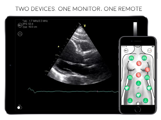 Awesome Ultrasound Simulator for iOS (iPhone/iPad/Apple TV/iPod touch ...