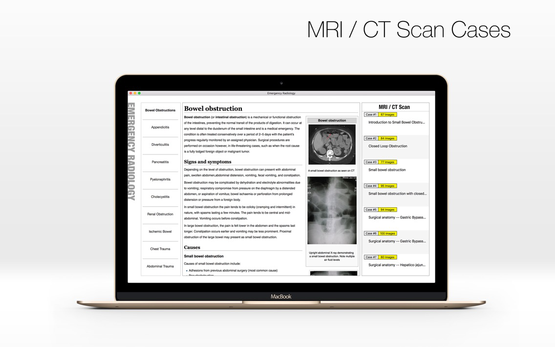 Emergency Radiology - Learn MRI and CT Scan Imaging Cases for iOS ...