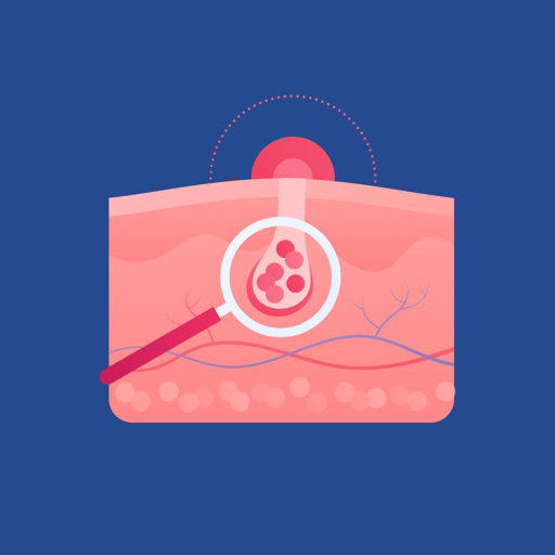 Dermatology: skin rash & acne for iOS (iPhone/iPod touch) - Free ...