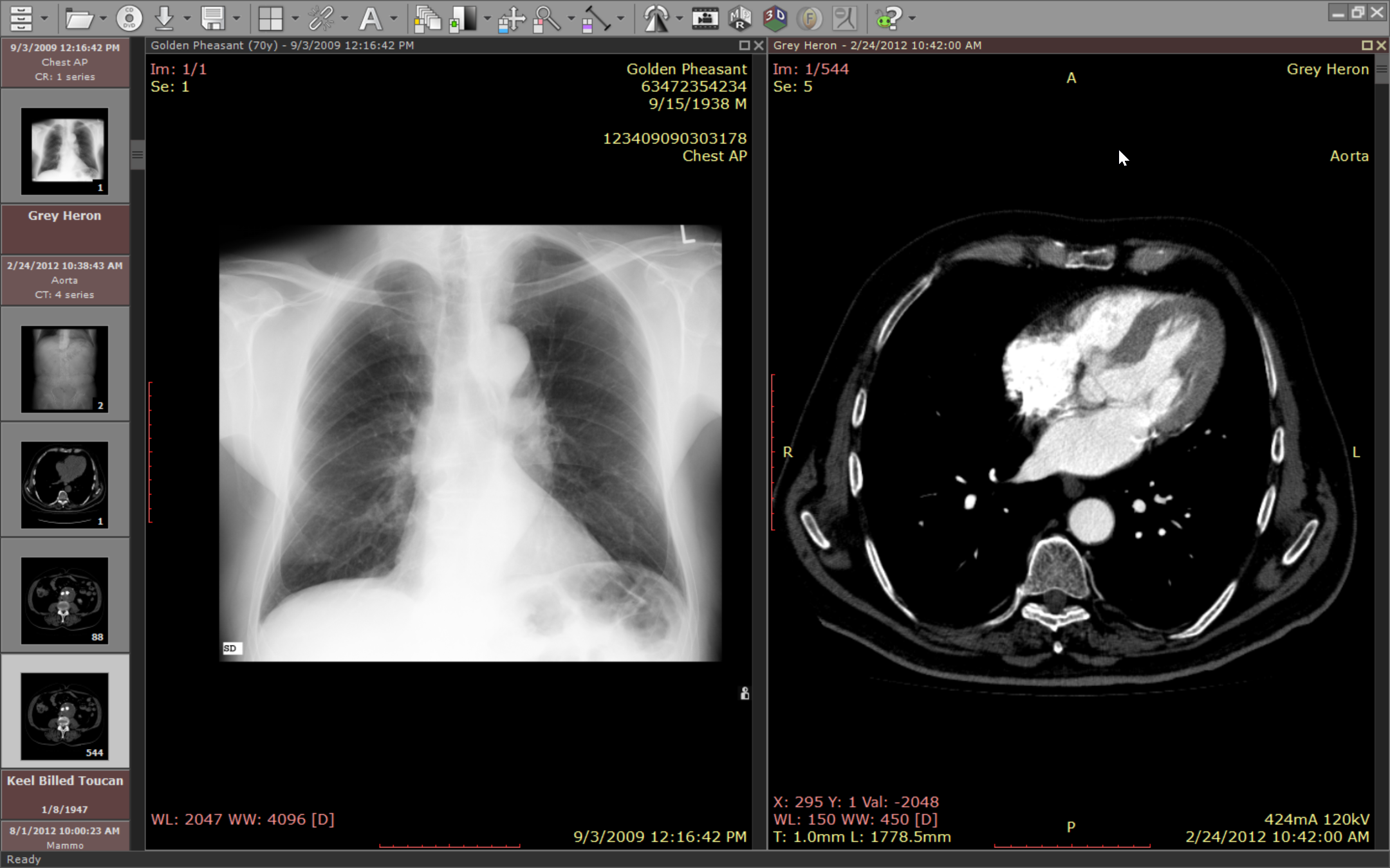 RadiAnt DICOM Viewer for PC Windows Download
