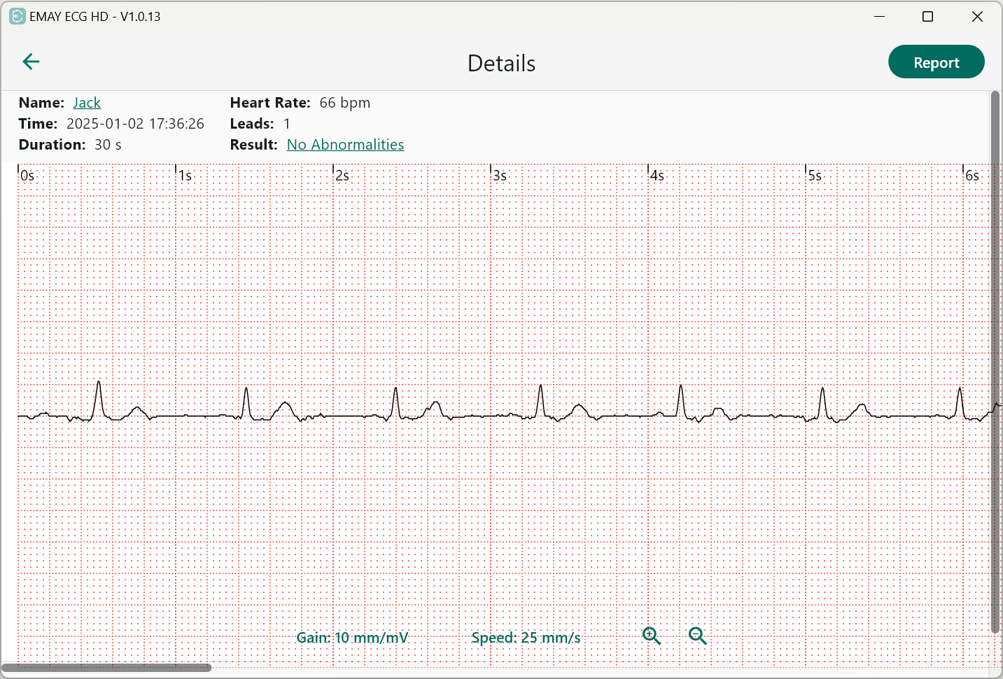 EMAY ECG HD for PC Windows Download
