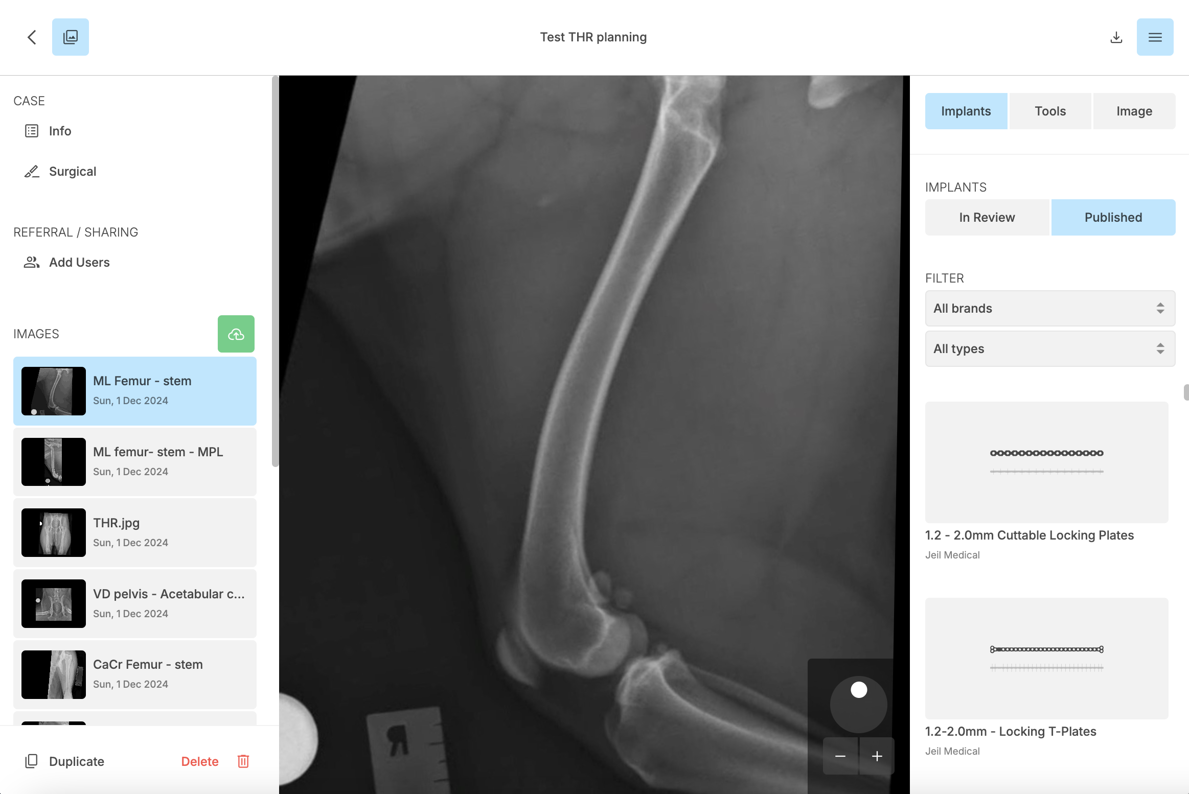 VPOP® PRO for PC Windows Download