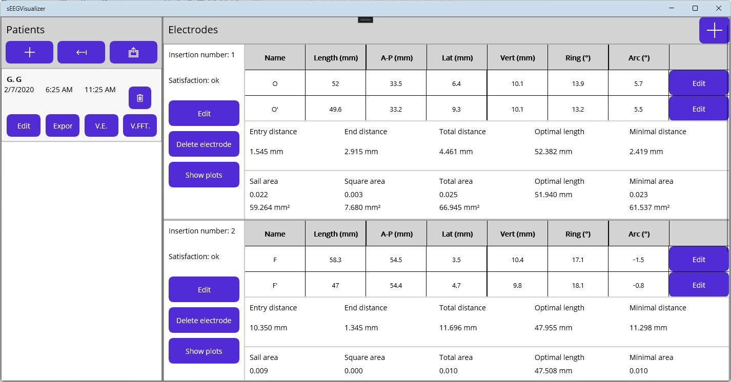 sEEG visualizer for PC Windows Download