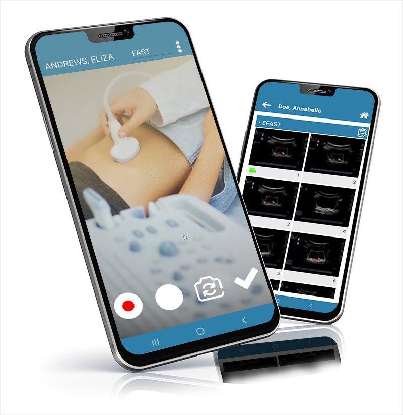 Qpath E APK für Android herunterladen
