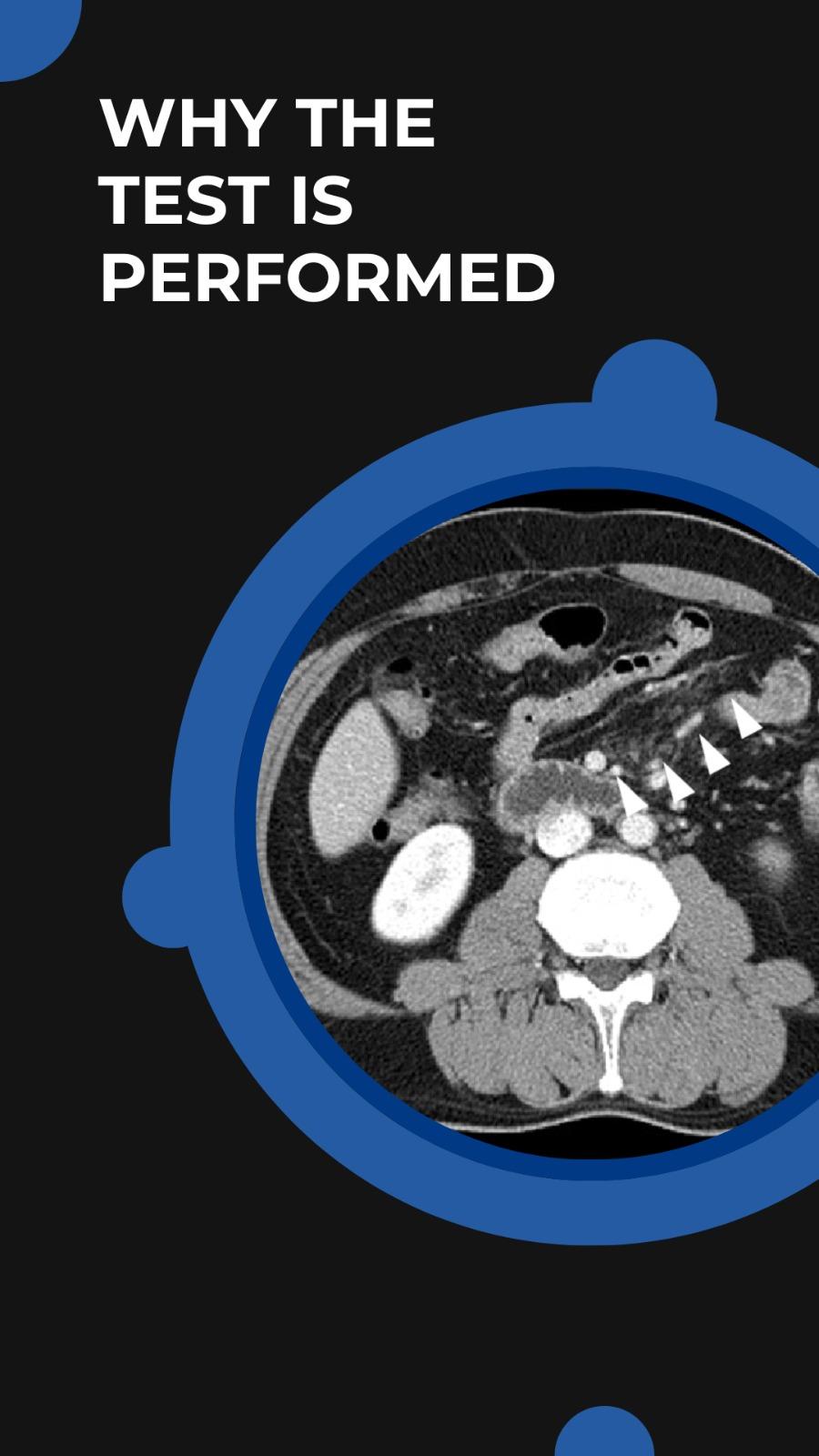 CT Scan Abdomen APK for Android Download CT Scan Abdomen APK for Android Download