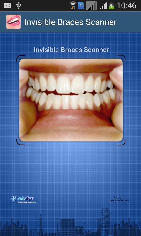 Invisible Braces Scan APK for Android Download