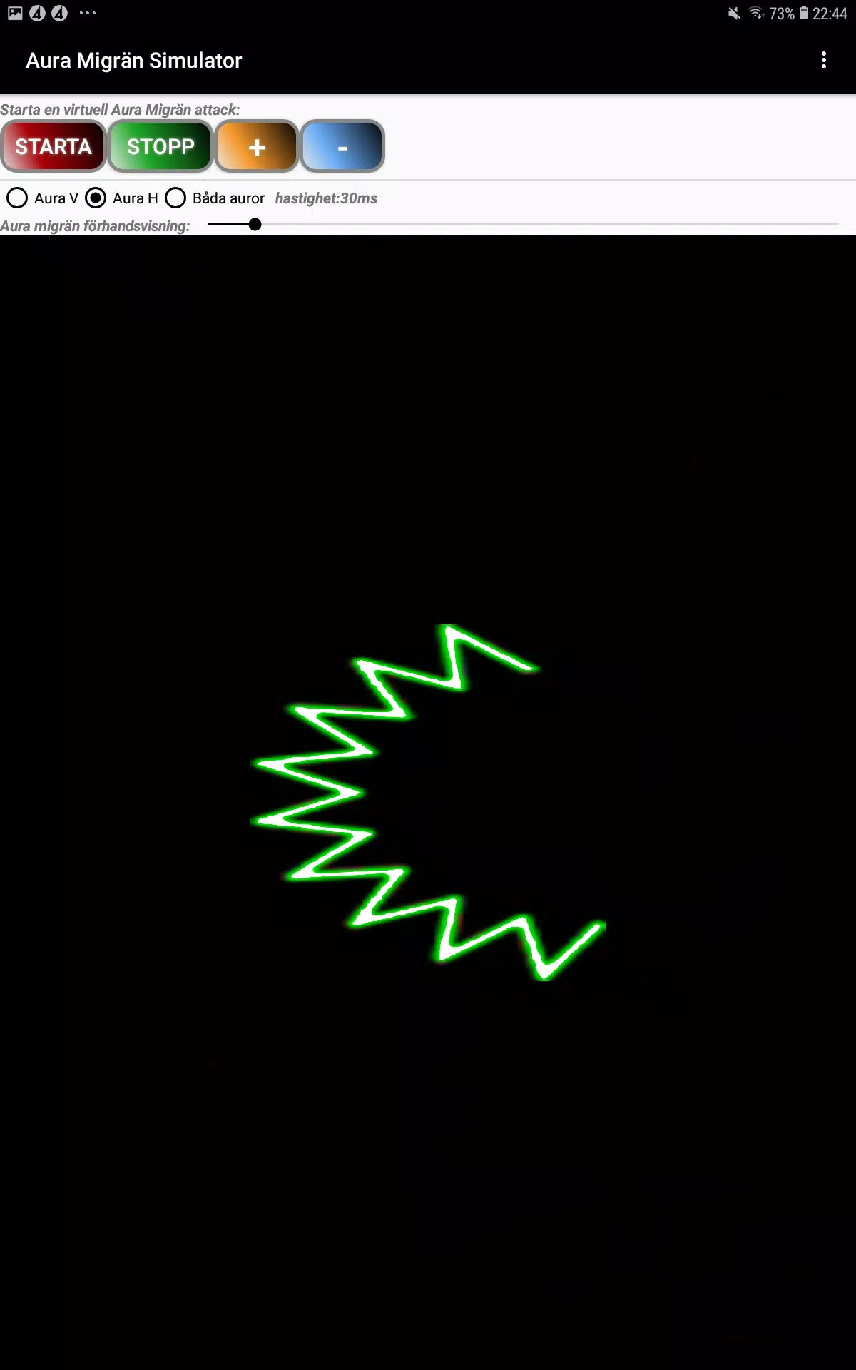 Migraine Aura Simulation