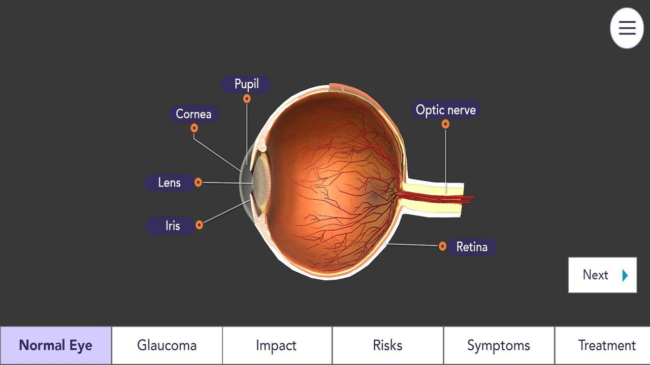 Zivira Glaucoma APK for Android Download
