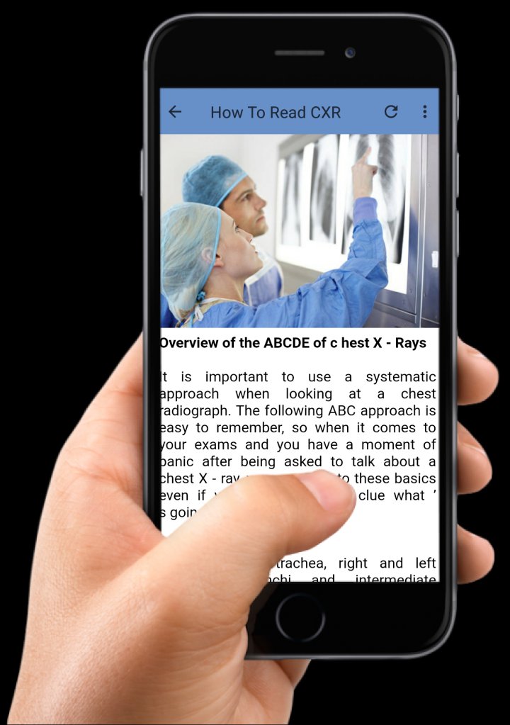 Chest X Ray Pathology And Anatomy APK Download for Android - Latest Version